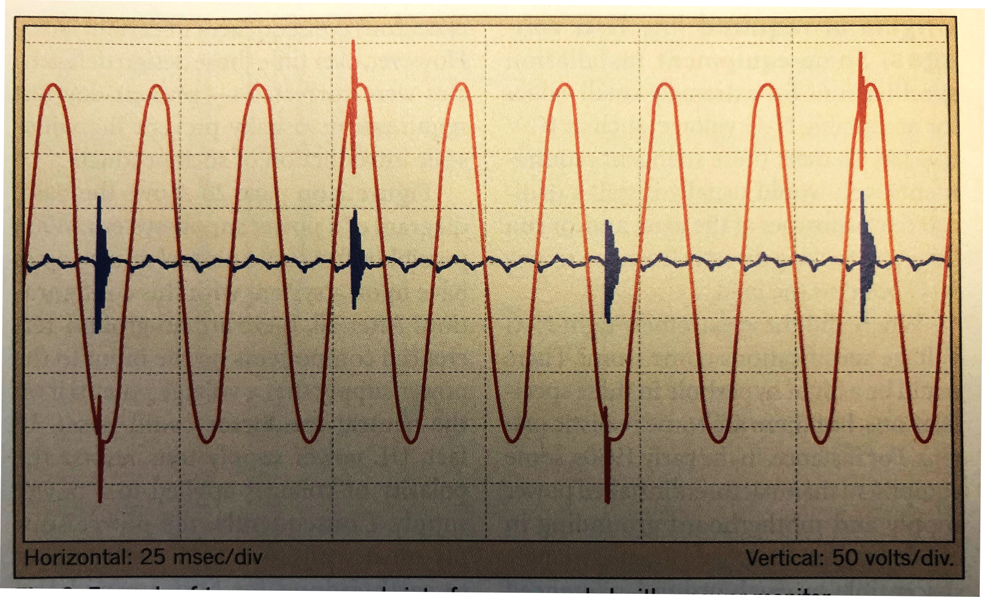 Clearing Up Neutral-to-Ground Voltage Confusion | EC&M